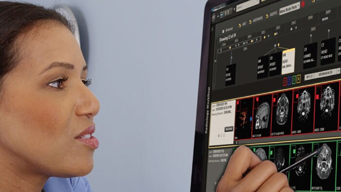 IntelliSpace Enterprise Imaging Solution | Enterprise Imaging PACS ...