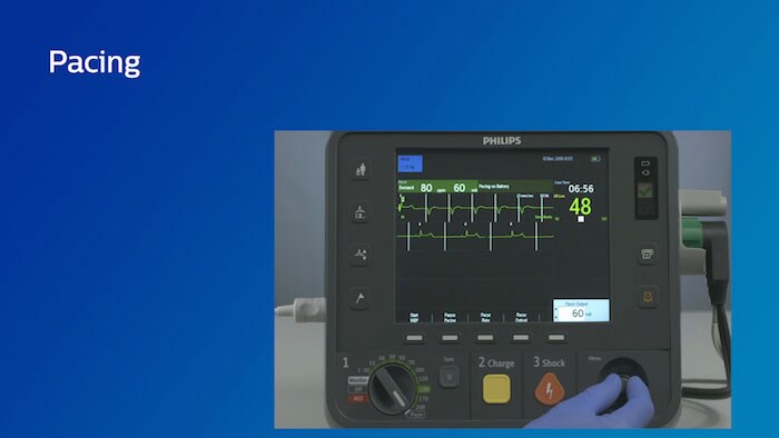 HeartStart Intrepid ALS support | Philips