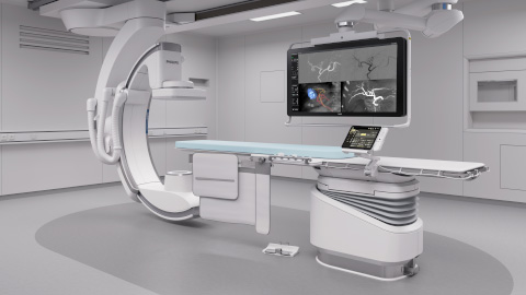 Prostate Artery Embolization (PAE) | Philips