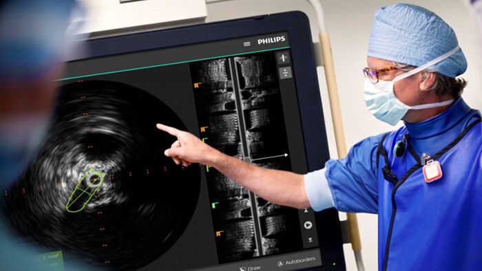 Peripheral arterial interventions | Philips Healthcare