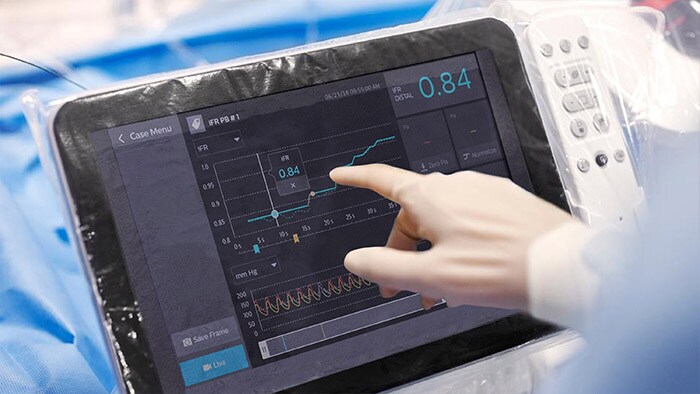 IntraSight Interventional Applications Platform | Philips